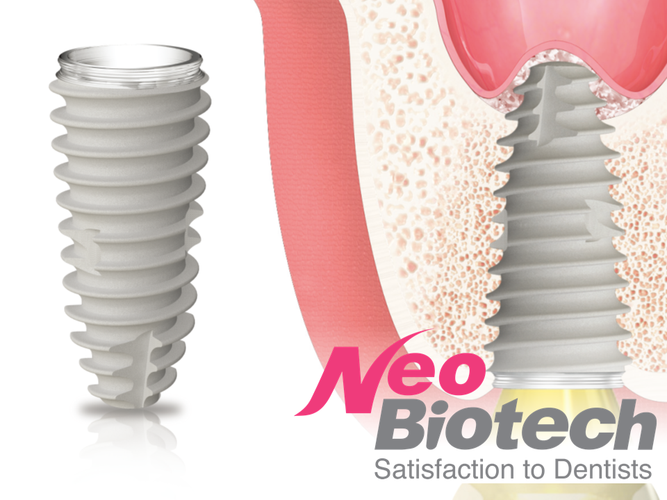 Neobiotech IS インプラントシステム - 【公式】和田精密歯研株式会社